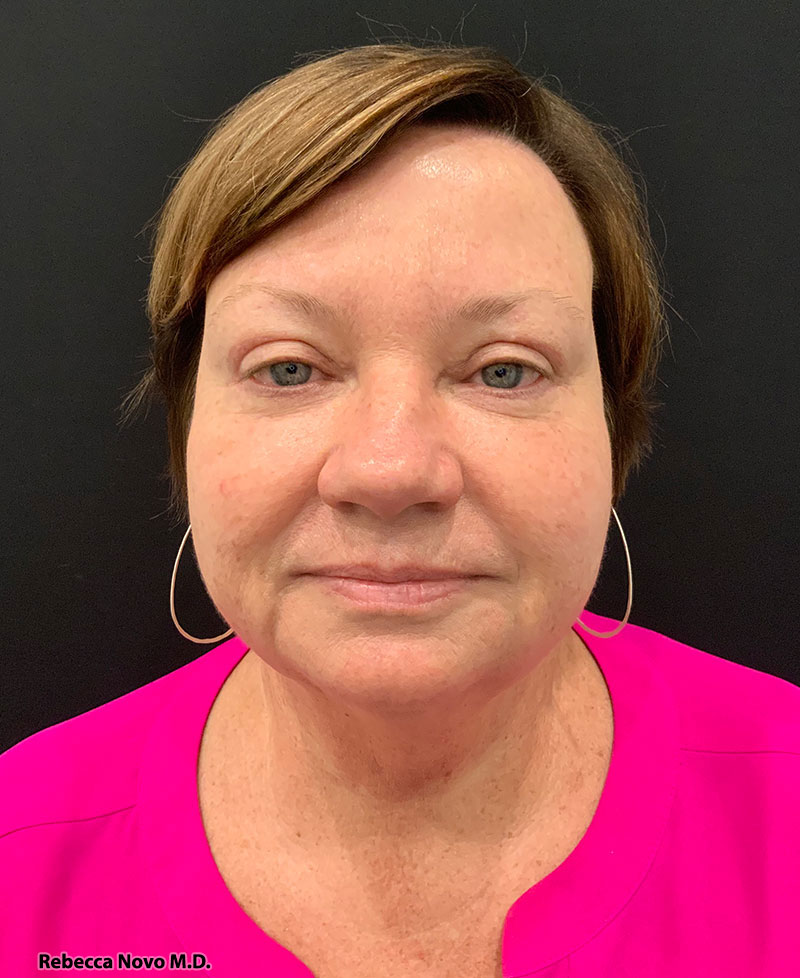 6896 Before and After Photos Melbourne, FL