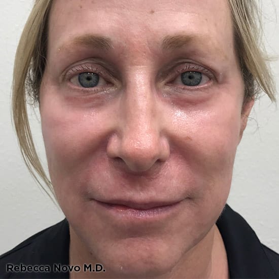 8888 Before and After Photos Melbourne, FL