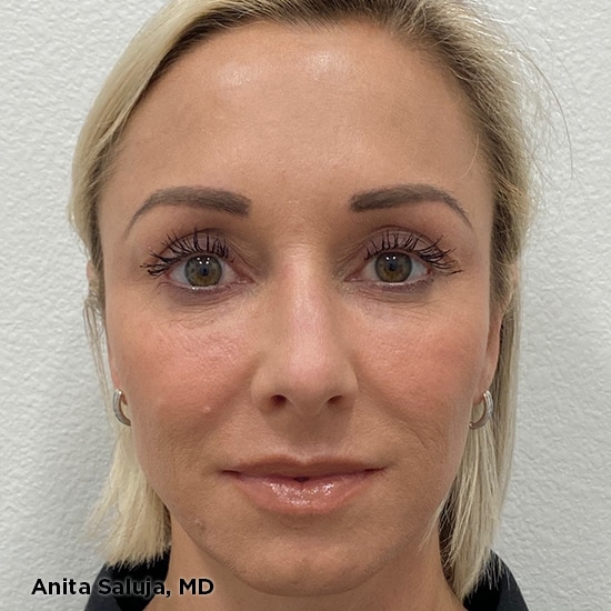 1973 Before and After Photos Melbourne, FL