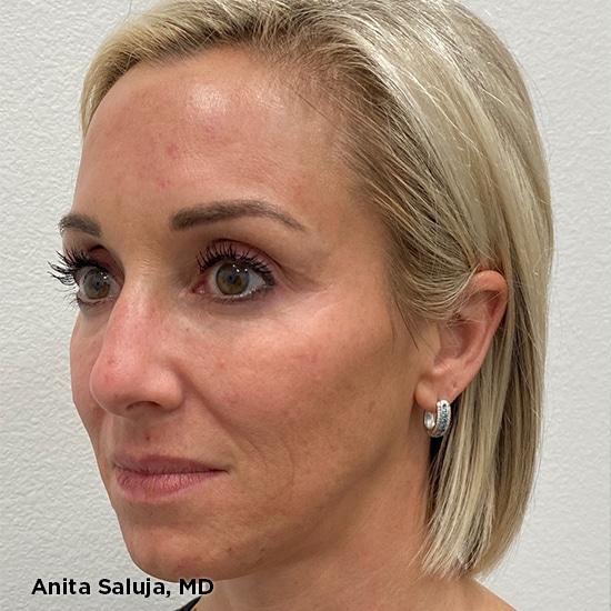 1973 Before and After Photos Melbourne, FL