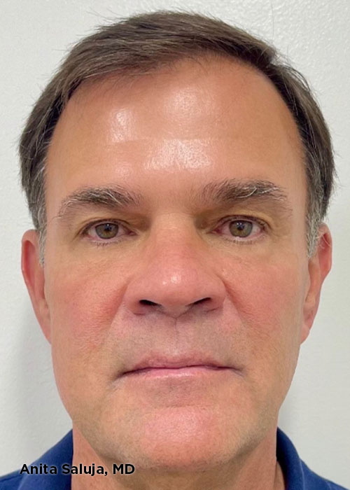 789548 Before and After Photos Melbourne, FL