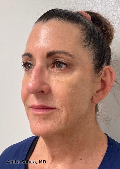 67574 Before and After Photos Melbourne, FL