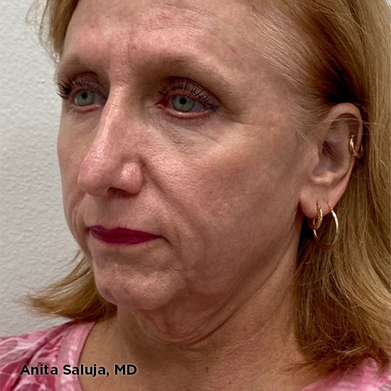 4847 Before and After Photos Melbourne, FL