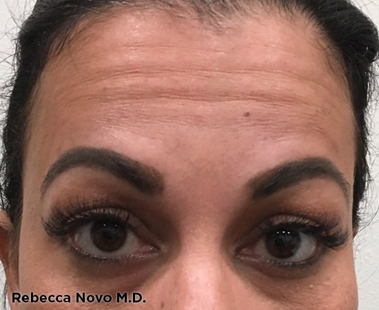 6925 Before and After Photos Melbourne, FL