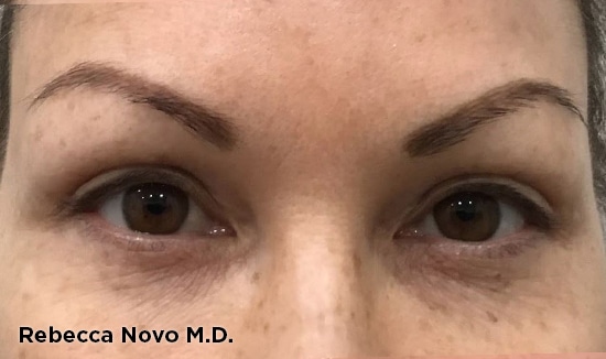 Hetter Peel | For Your Best Self