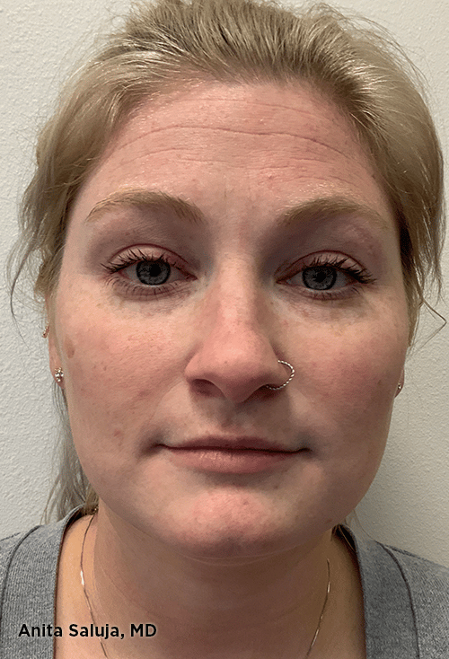 6923 Before and After Photos Melbourne, FL