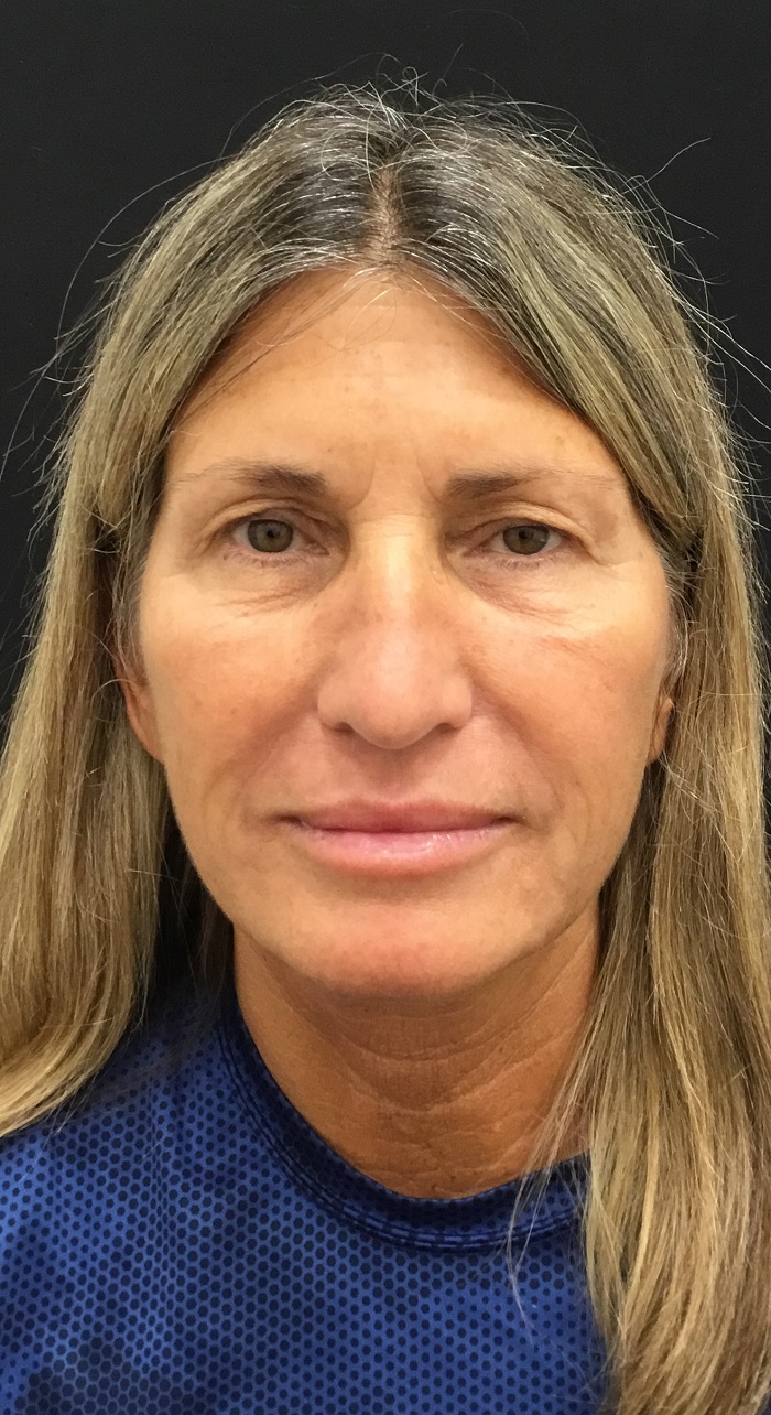 6898 Before and After Photos Melbourne, FL