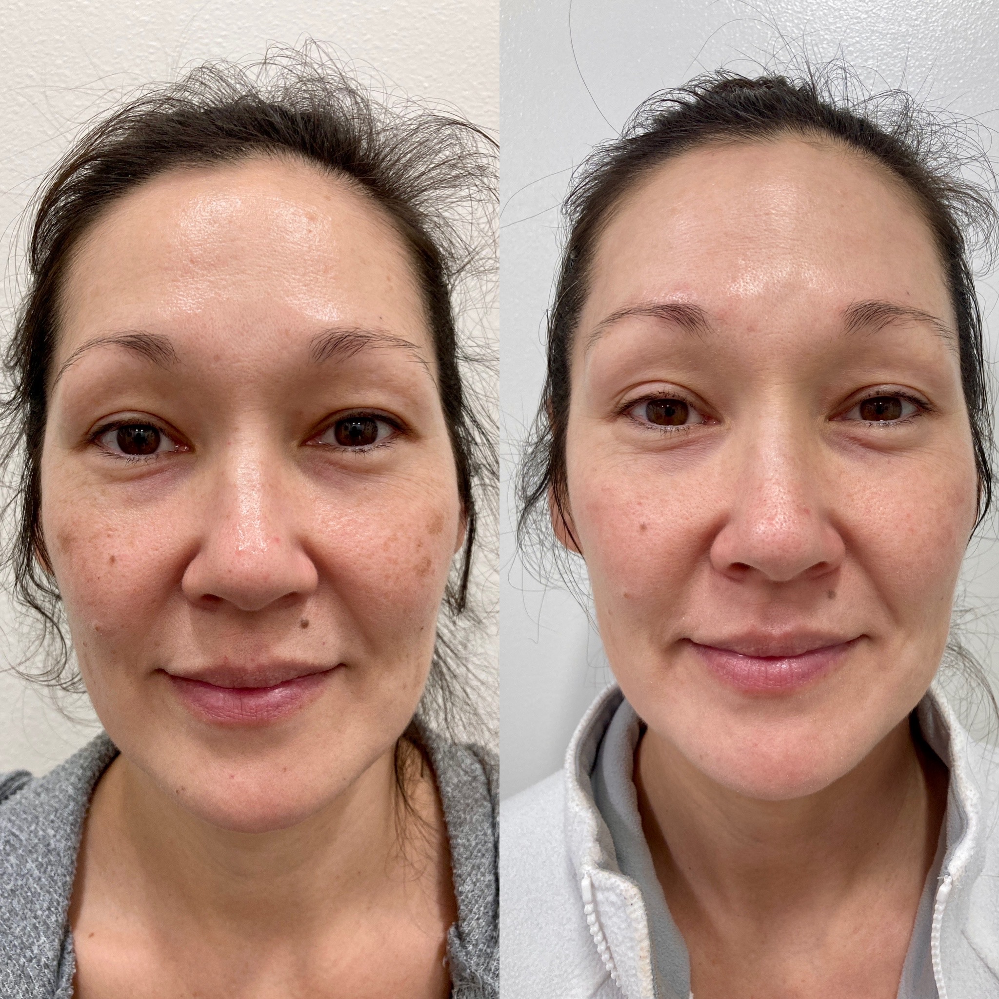 46713 Before and After Photos Melbourne, FL