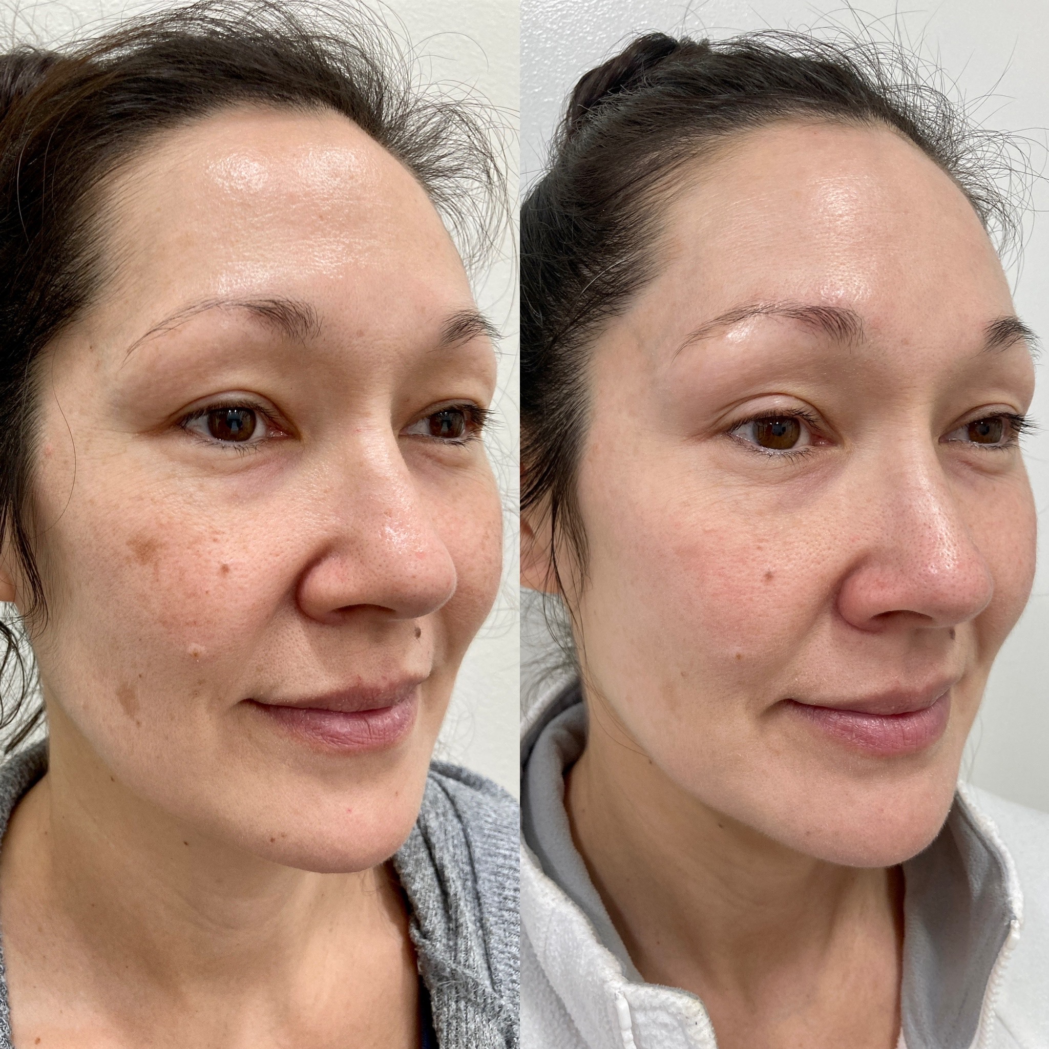 46713 Before and After Photos Melbourne, FL