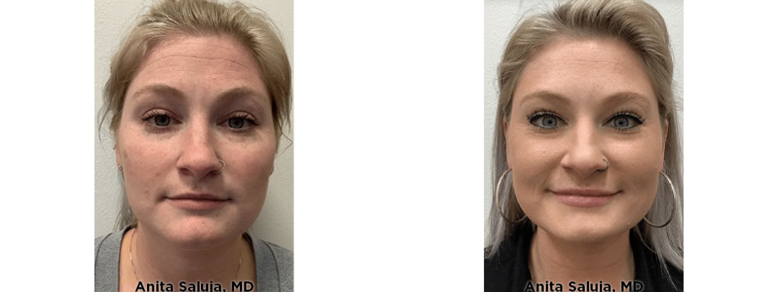 6923 Before and After Photos Melbourne, FL