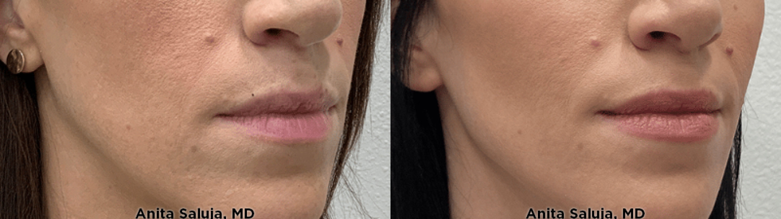 6947 Before and After Photos Melbourne, FL