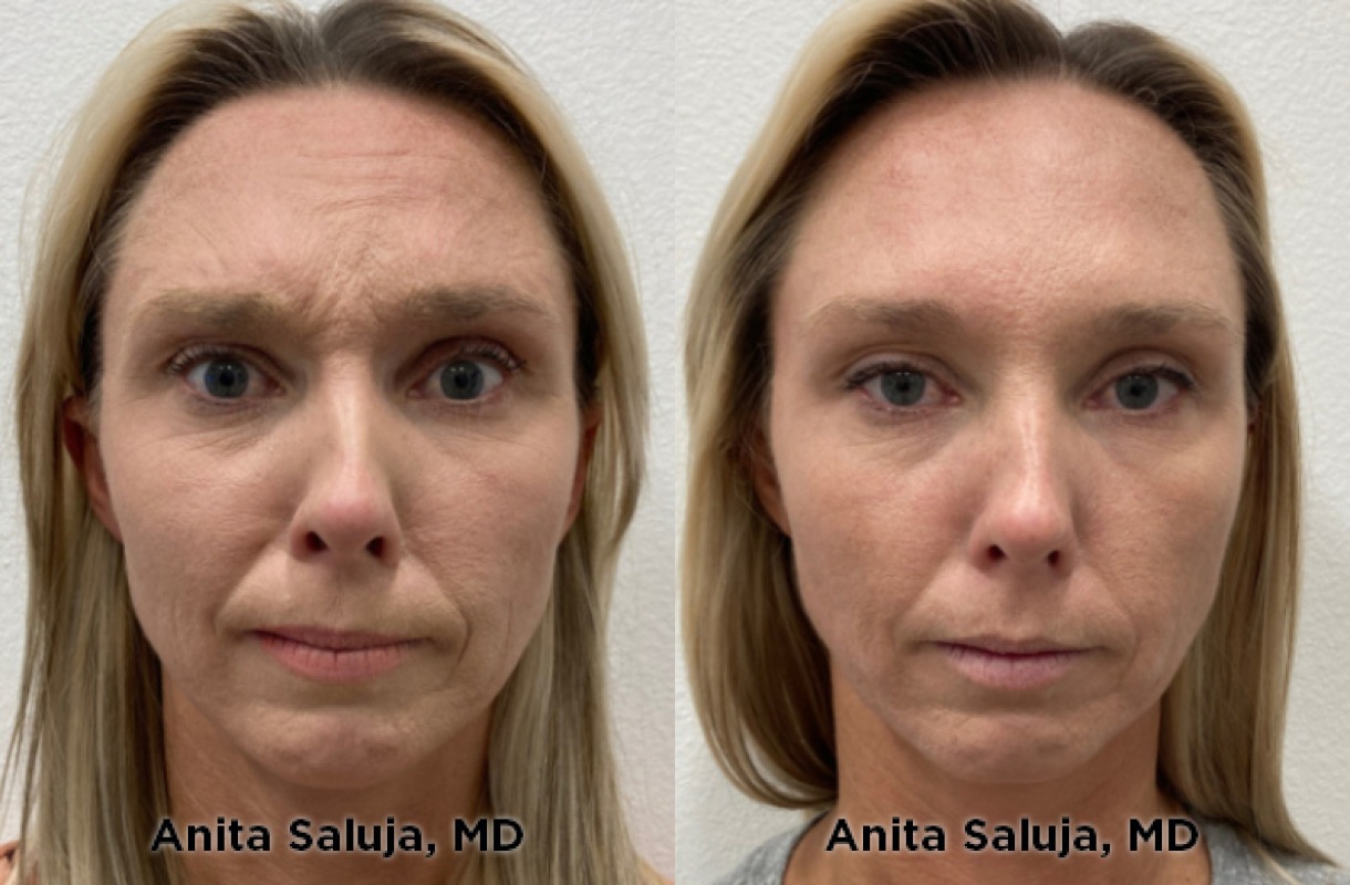 2375 Before and After Photos Melbourne, FL